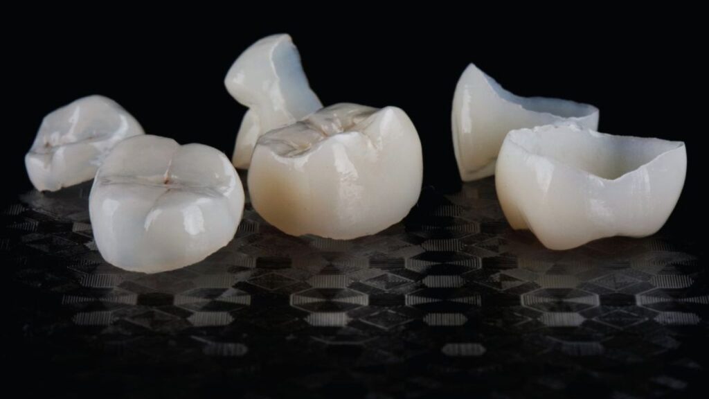 Sydney’s Secret to a Radiant Smile: Mastering the Craft of Porcelain ...