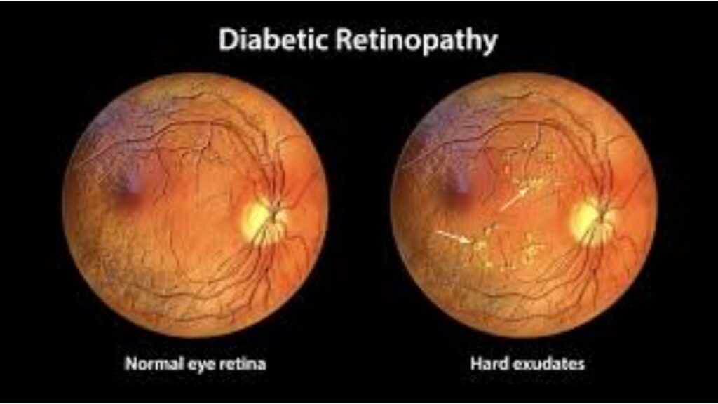 What to Expect During an Eye Exam for Diabetic Retinopathy - Wildlab sky